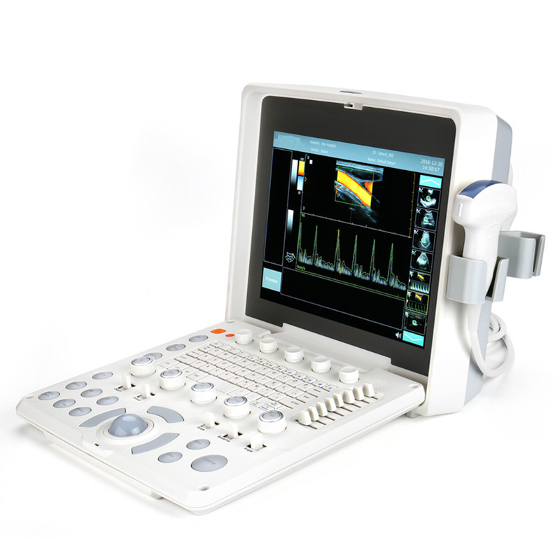 Scanner portatif d'ultrason de dispositif de Doppler de couleur d ...