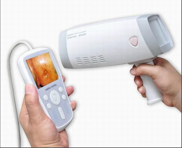 Colposcope cervical tenu dans la main d'appareil-photo de Digital pour ...